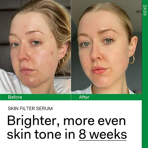 The Nue Co. Skin Filter Daily Brightening Phyto-Retinol + AHA Serum ...